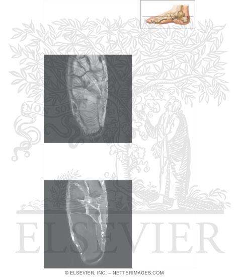 Cross Section of the Ankle and Foot: Axial View