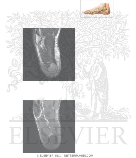 Cross Section of the Ankle and Foot: Axial View