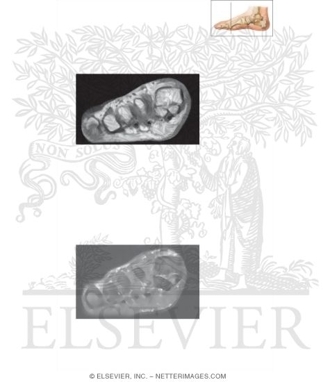 Cross Section of the Ankle and Foot: Coronal View