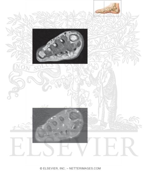 Cross Section of the Ankle and Foot: Coronal View