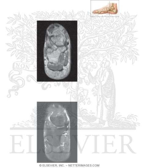 Cross Section of the Ankle and Foot: Coronal View