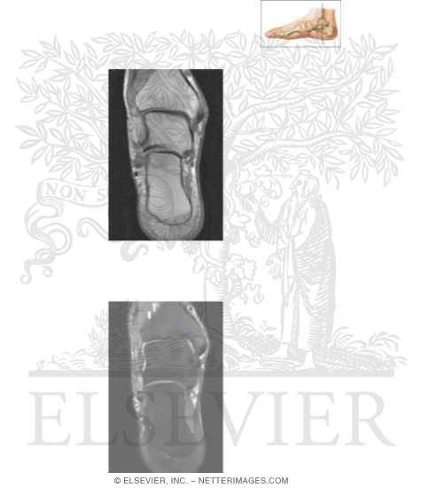 Cross Section of the Ankle and Foot: Coronal View
