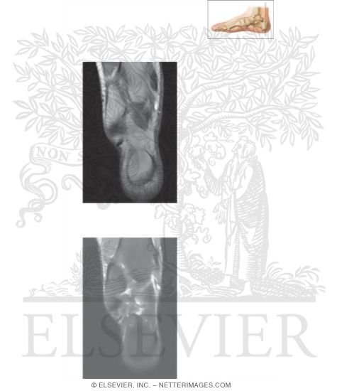 Cross Section of the Ankle and Foot: Coronal View