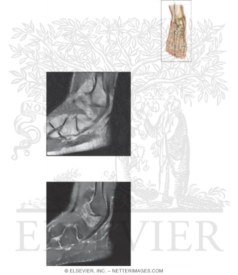 Cross Section of the Ankle and Foot: Coronal View