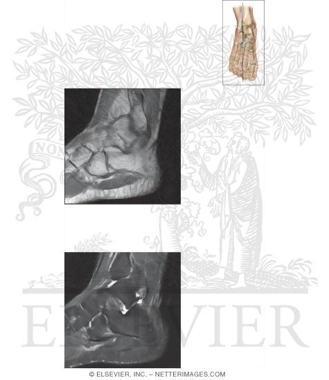 Cross Section of the Ankle and Foot: Coronal View