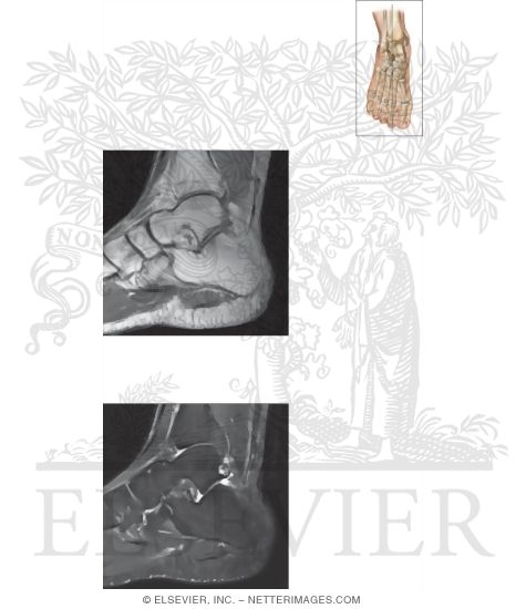 Cross Section of the Ankle and Foot: Coronal View