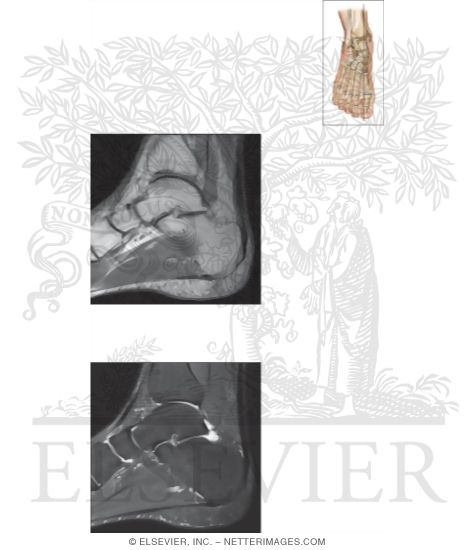 Cross Section of the Ankle and Foot: Coronal View
