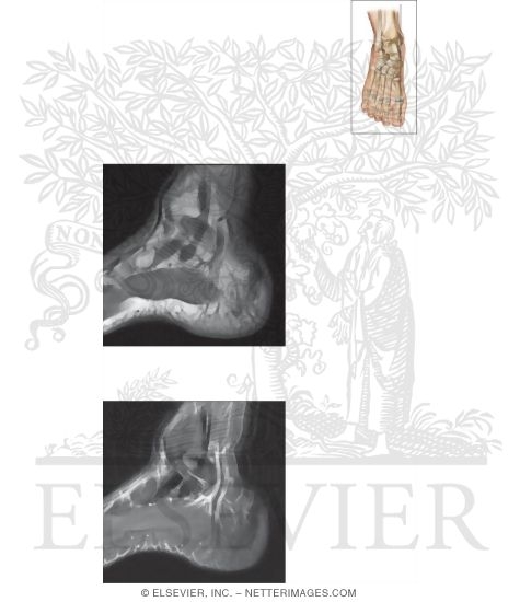 Cross Section of the Ankle and Foot: Coronal View