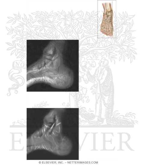 Cross Section of the Ankle and Foot: Coronal View