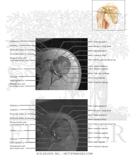 Cross Section of the Shoulder: Axial View