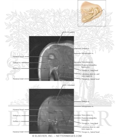 Cross Section of the Shoulder: Coronal View