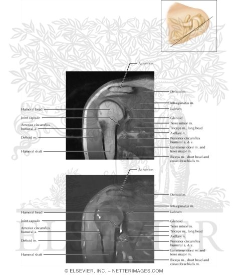 Cross Section of the Shoulder: Coronal View