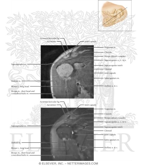 Cross Section of the Shoulder: Coronal View