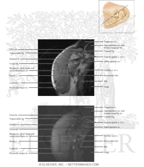 Cross Section of the Shoulder: Coronal View