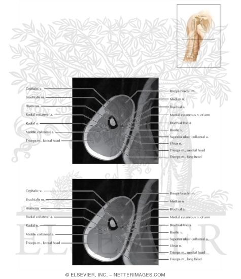 Cross Section of the Arm: Axial View