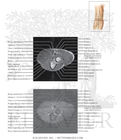 Cross Section of the Elbow: Axial View