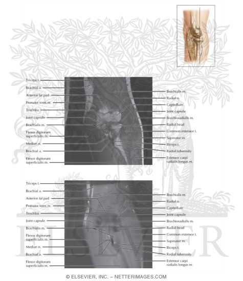Cross Section of the Elbow: Coronal View