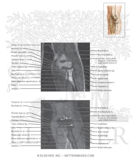 Cross Section of the Elbow: Coronal View