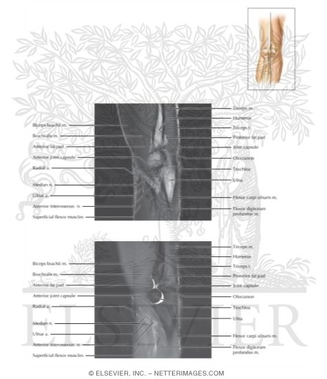 Cross Section of the Elbow: Sagittal View