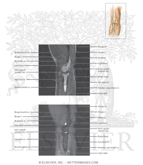 Cross Section of the Elbow: Sagittal View
