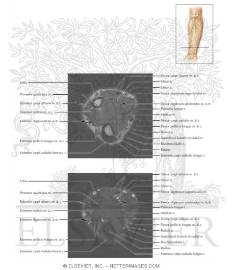 Cross Section of the Forearm: Axial View