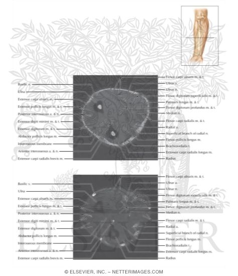 Cross Section of the Forearm: Axial View