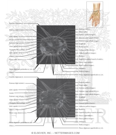 Cross Section of the Wrist: Axial View