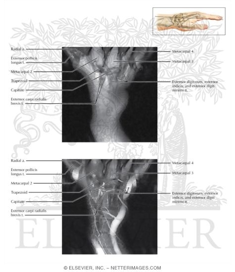 Cross Section of the Wrist: Coronal View