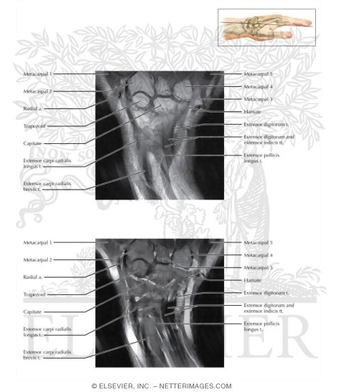 Cross Section of the Wrist: Coronal View