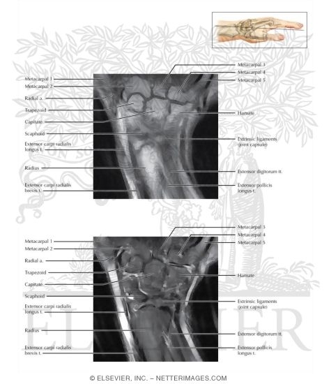 Cross Section of the Wrist: Coronal View