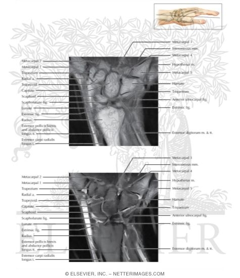 Cross Section of the Wrist: Coronal View