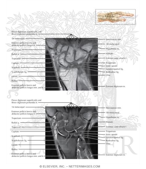 Cross Section of the Wrist: Coronal View