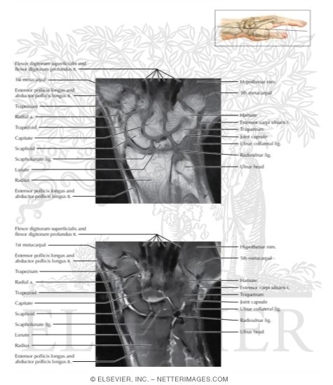 Cross Section of the Wrist: Coronal View