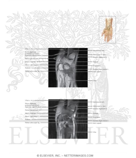 Cross Section of the Wrist: Sagittal View