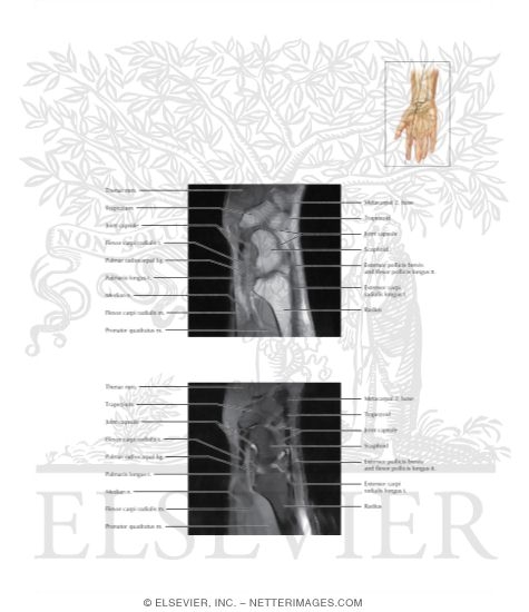 Cross Section of the Wrist: Sagittal View