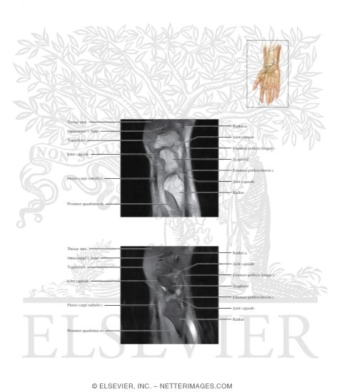 Cross Section of the Wrist: Sagittal View