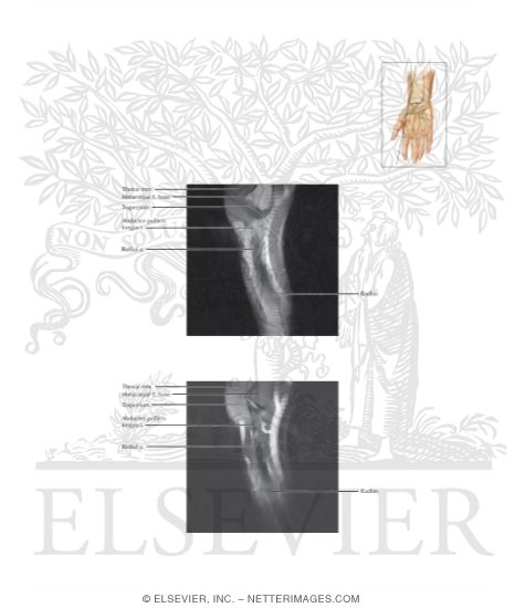 Cross Section of the Wrist: Sagittal View