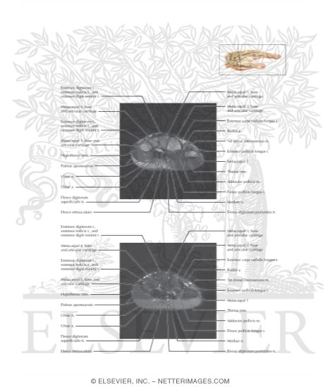 Cross Section of the Hand: Axial View