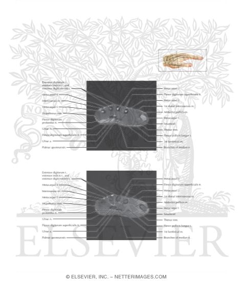 Cross Section of the Hand: Axial View
