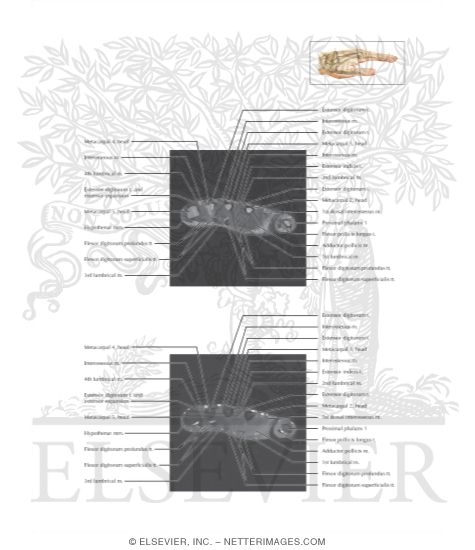 Cross Section of the Hand: Axial View