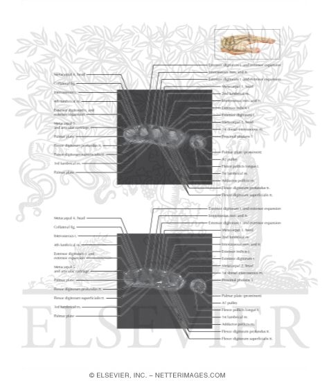 Cross Section of the Hand: Axial View