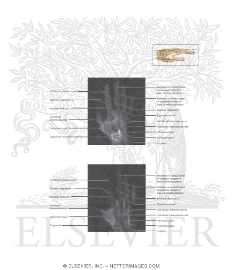 Cross Section of the Hand and Finger: Coronal View