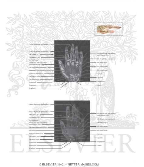 Cross Section of the Hand and Finger: Coronal View