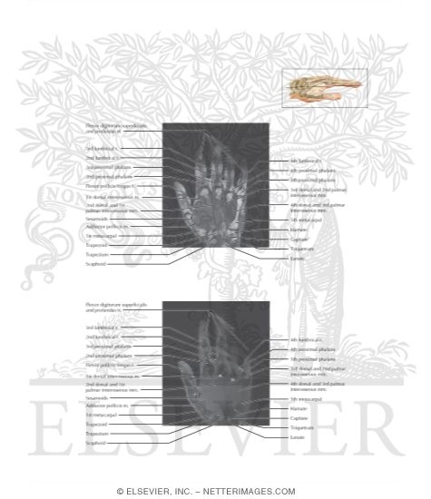 Cross Section of the Hand and Finger: Coronal View
