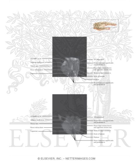Cross Section of the Hand and Finger: Coronal View