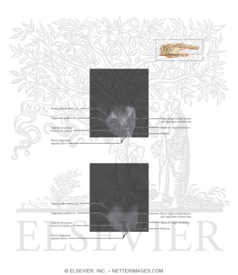Cross Section of the Hand and Finger: Coronal View