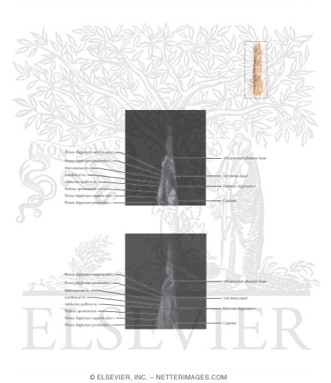 Cross Section of the Hand and Finger: Sagittal View