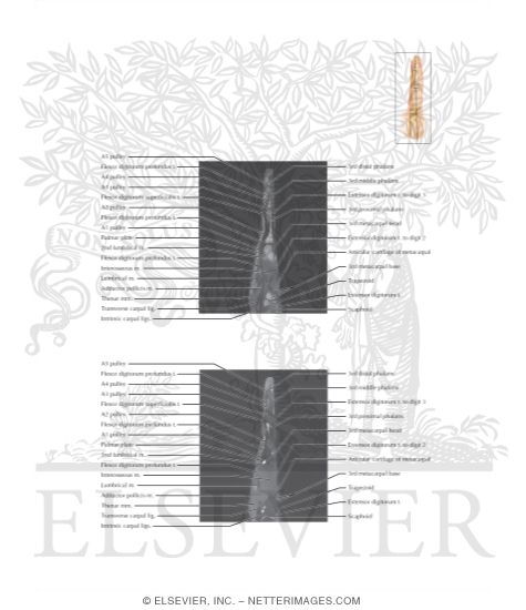 Cross Section of the Hand and Finger: Sagittal View
