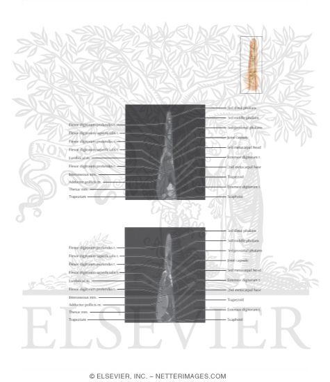 Cross Section of the Hand and Finger: Sagittal View