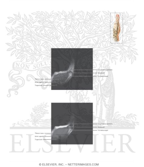 Cross Section of the Thumb: Sagittal View